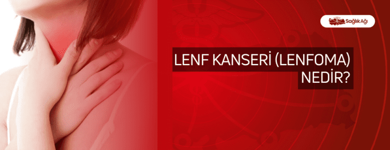 Lenf Kanseri (Lenfoma) Nedir? - Sağlık Ağı